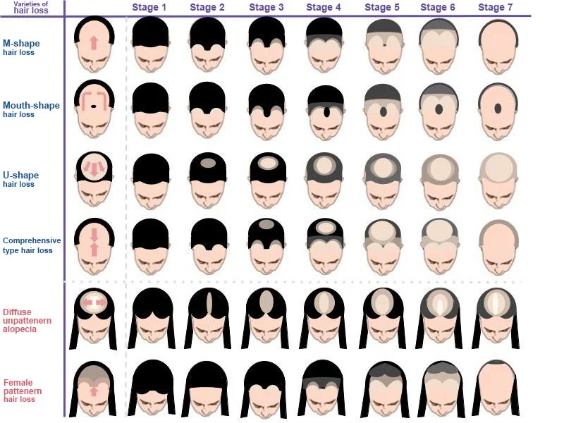 WELLNESS Hair Transplant